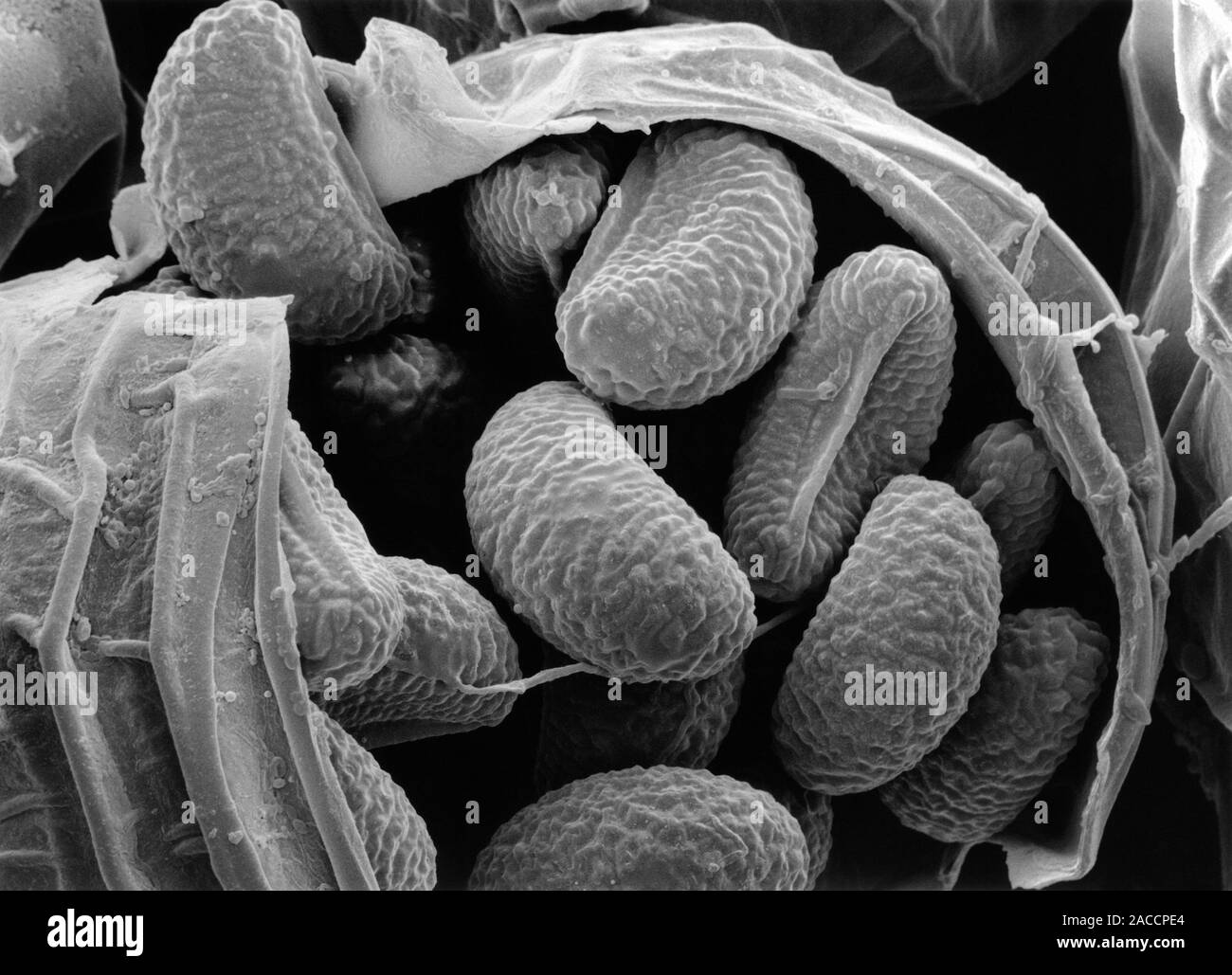 Scanning electron micrograph of a sporangium of the common polypody ...