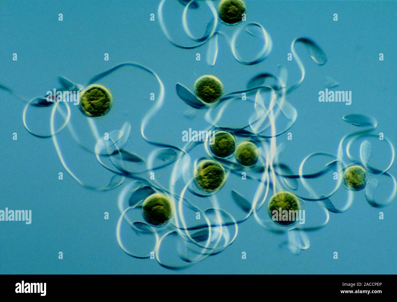 Light micrograph of the spores (brown spheres) of the field horsetail ...