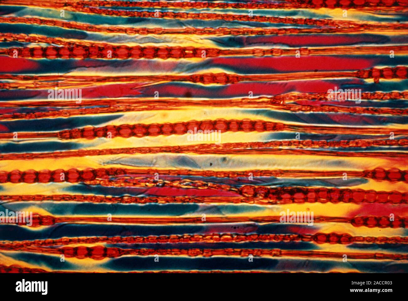 Light micrograph of a tangential section through white pine wood ...
