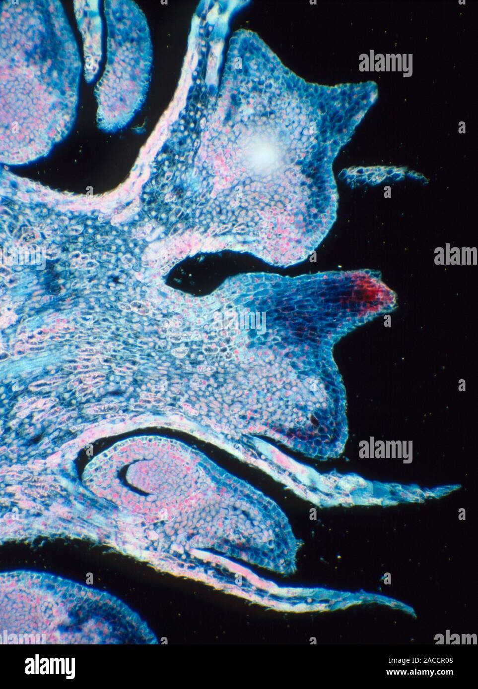 Light micrograph of a vertical section through an immature female pine ...