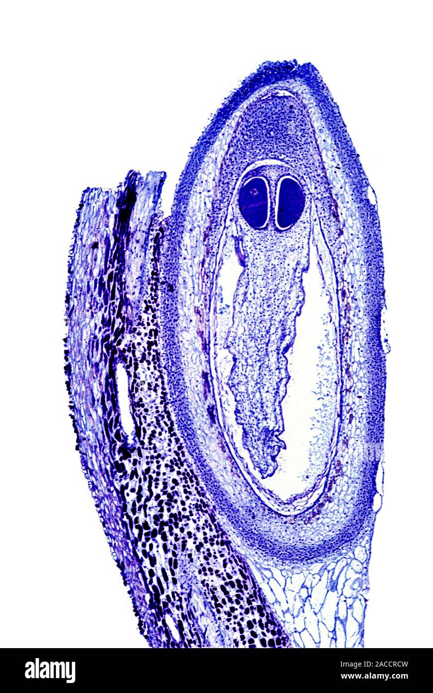 Pine cone scale. Light micrograph of a vertical section through an ...