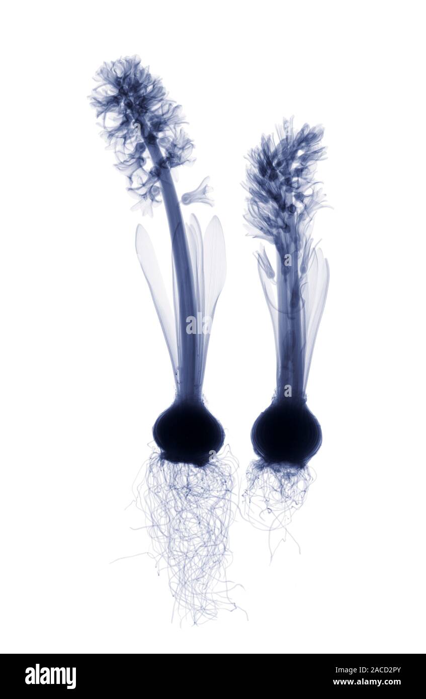 Hyacinths. Coloured X-ray of two hyacinth flowers (Hyacinthus sp Stock ...