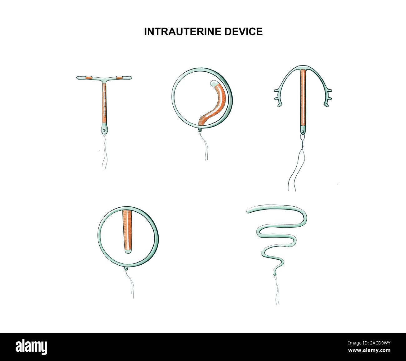 Illustration of the intrauterine device Stock Photo - Alamy