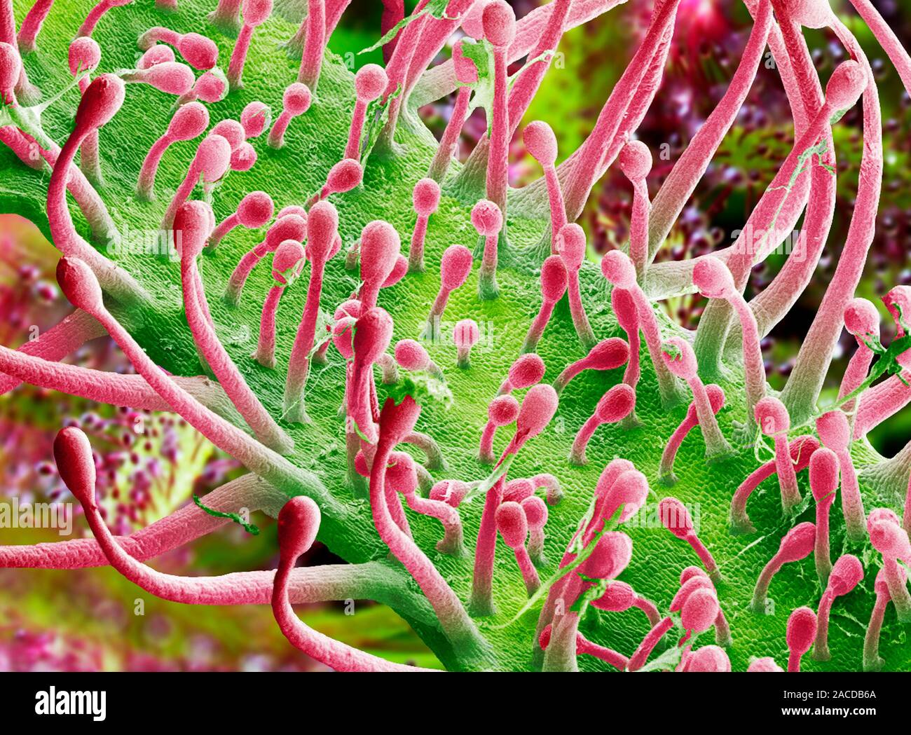 Sundew leaf. Coloured scanning electron micrograph (SEM) of the sticky ...