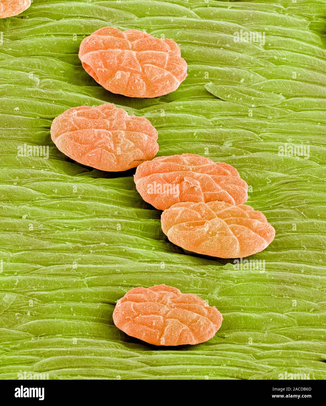 Venus flytrap digestive glands. Coloured scanning electron micrograph ...