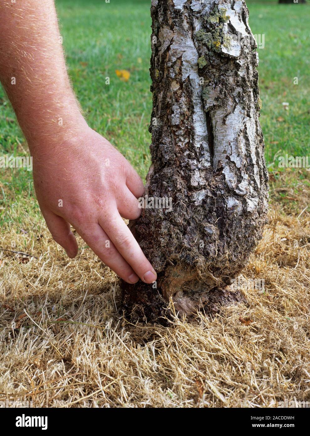 Damaged tree. Gardener pointing to a wound on the trunk of a birch tree ...