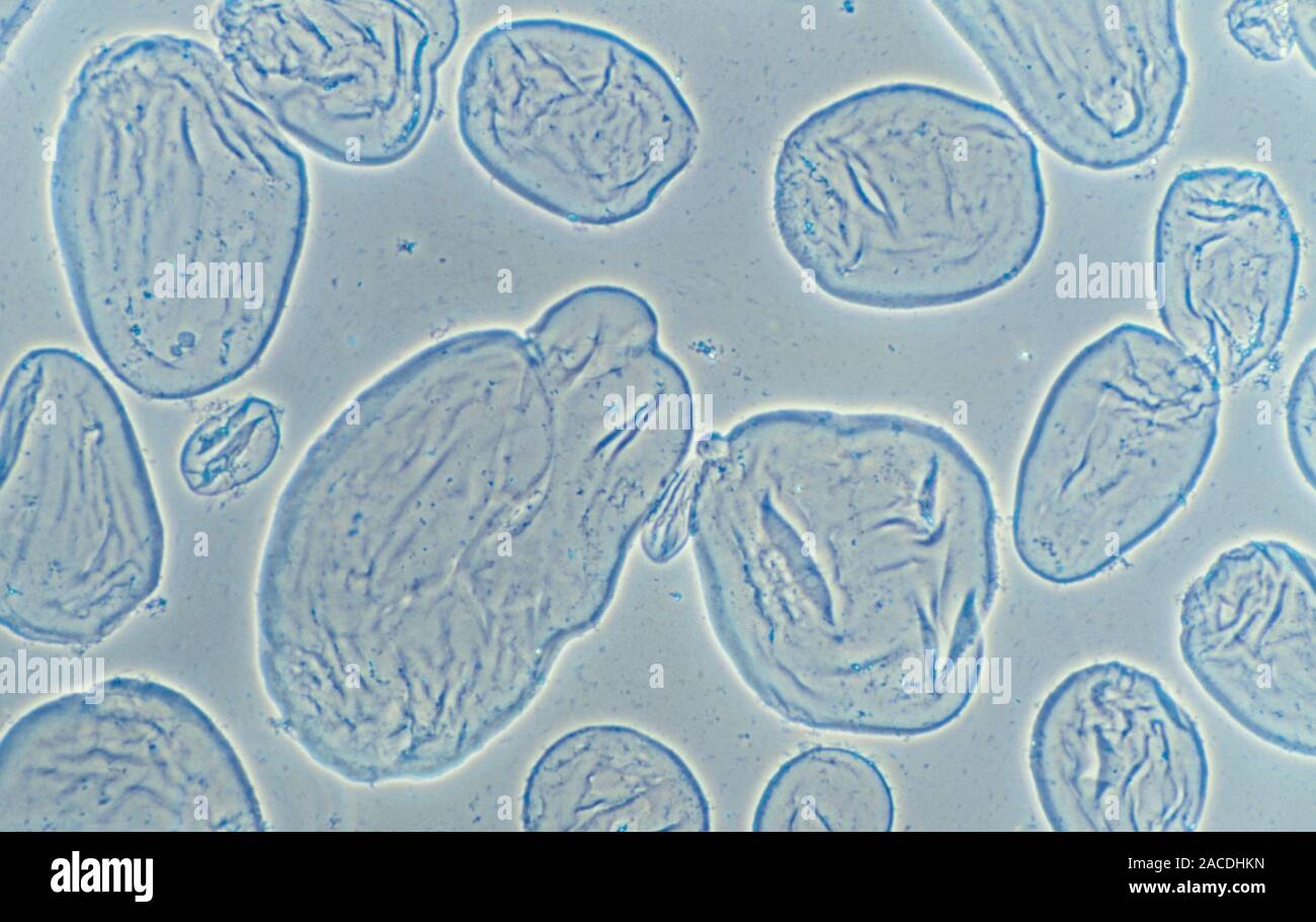 Light micrograph of hydrolysed starch granules from a potato, Solanum ...