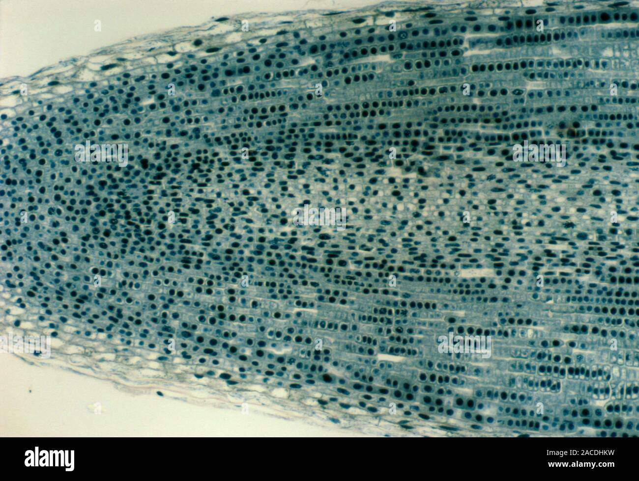 Light micrograph (longitudinal section) of the cells in the root tip of ...