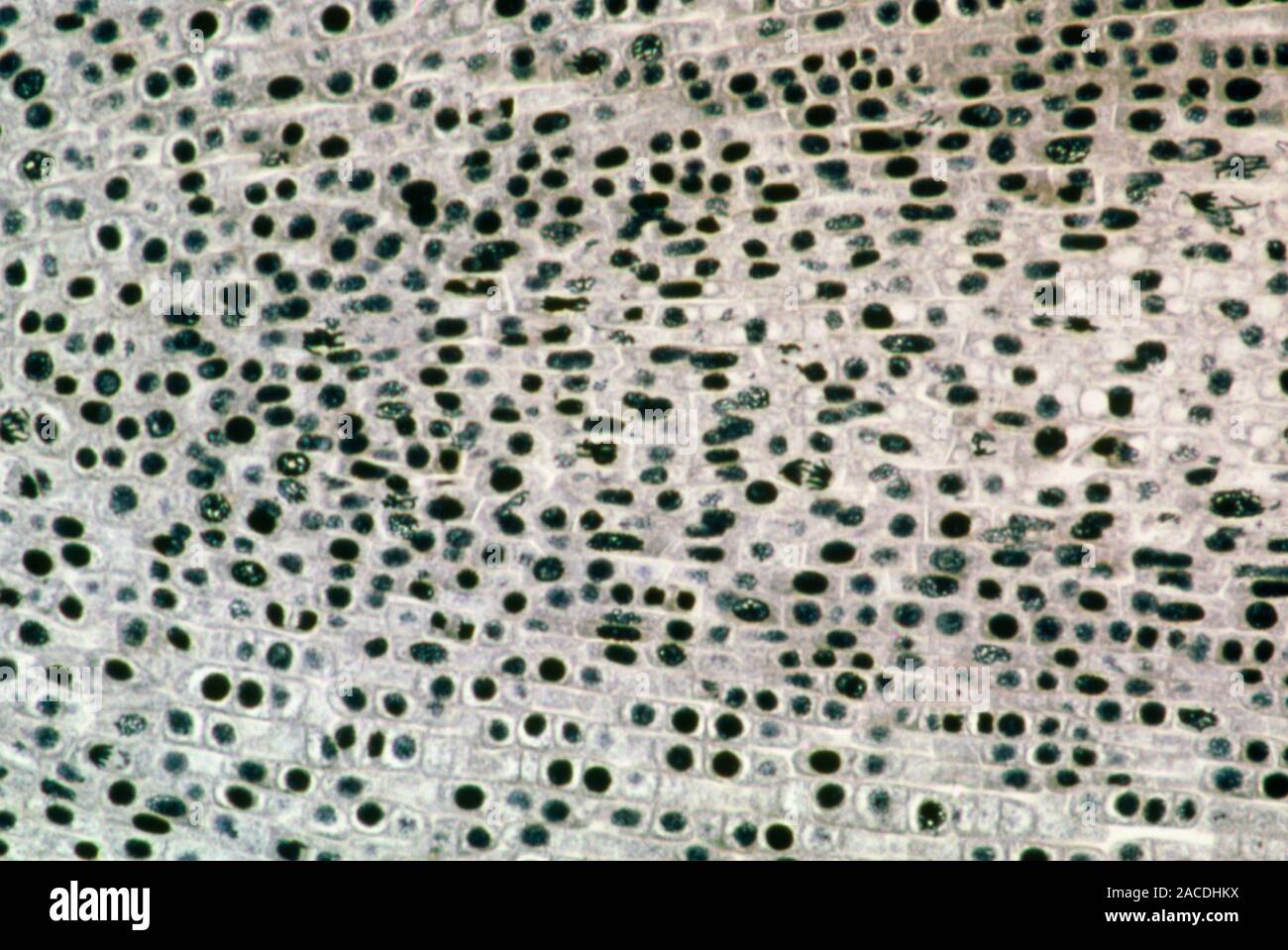 Light micrograph (longitudinal section) of the cells in the root tip of ...