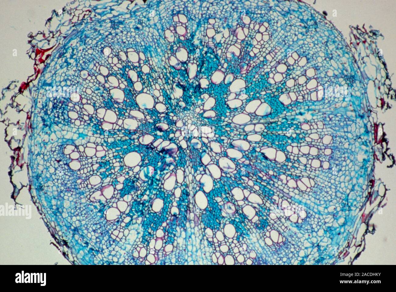 Light micrograph of a transverse section through the root of the broad ...