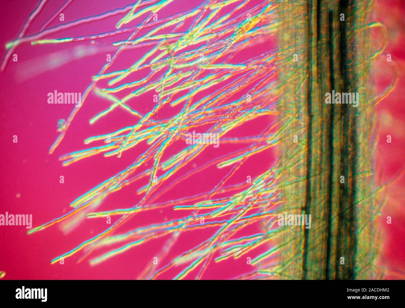Root hairs. Light micrograph of a young root of beetroot Beta vulgaris ...