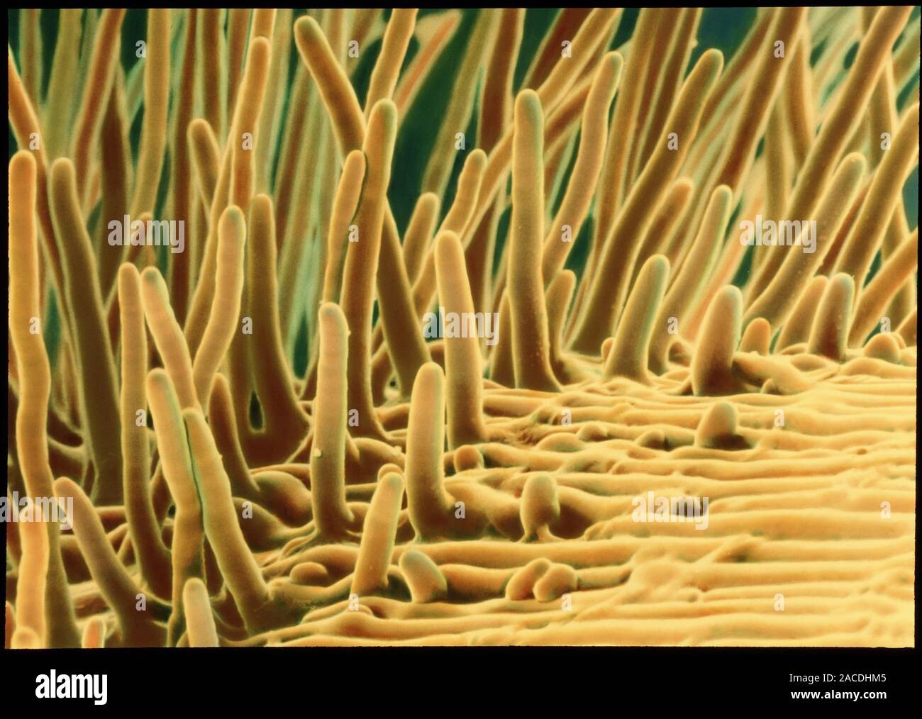 Root hairs. Coloured Scanning Electron Micrograph (SEM) of root hairs ...