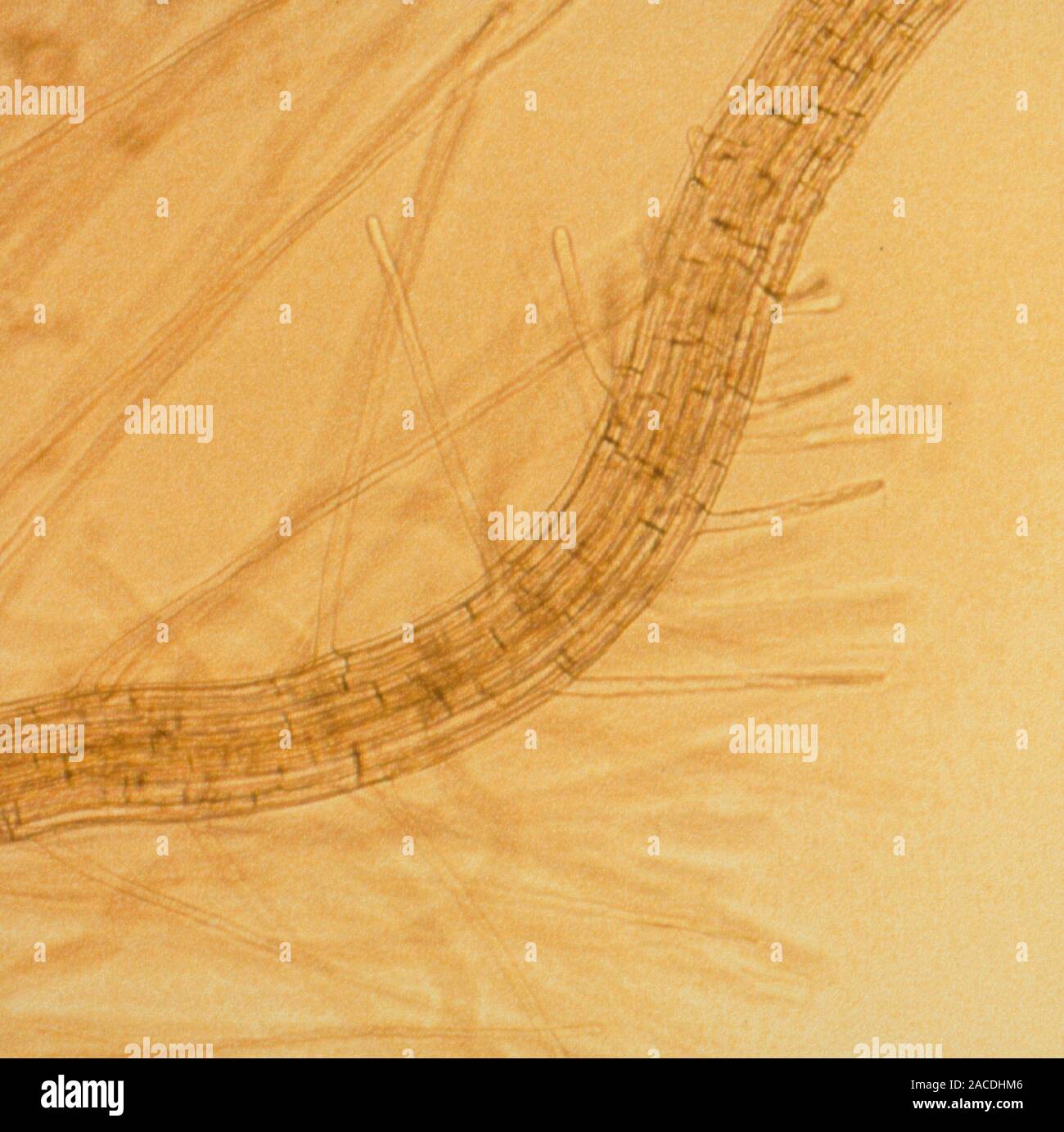 Thale cress root. Light micrograph (LM) of the root of a Thale cress ...