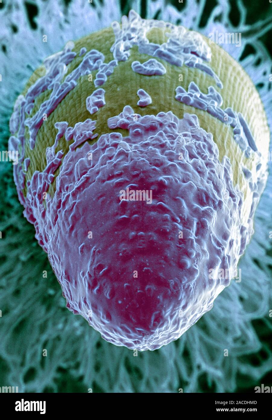 Root cap. Coloured scanning electron micrograph (SEM) of the root cap ...