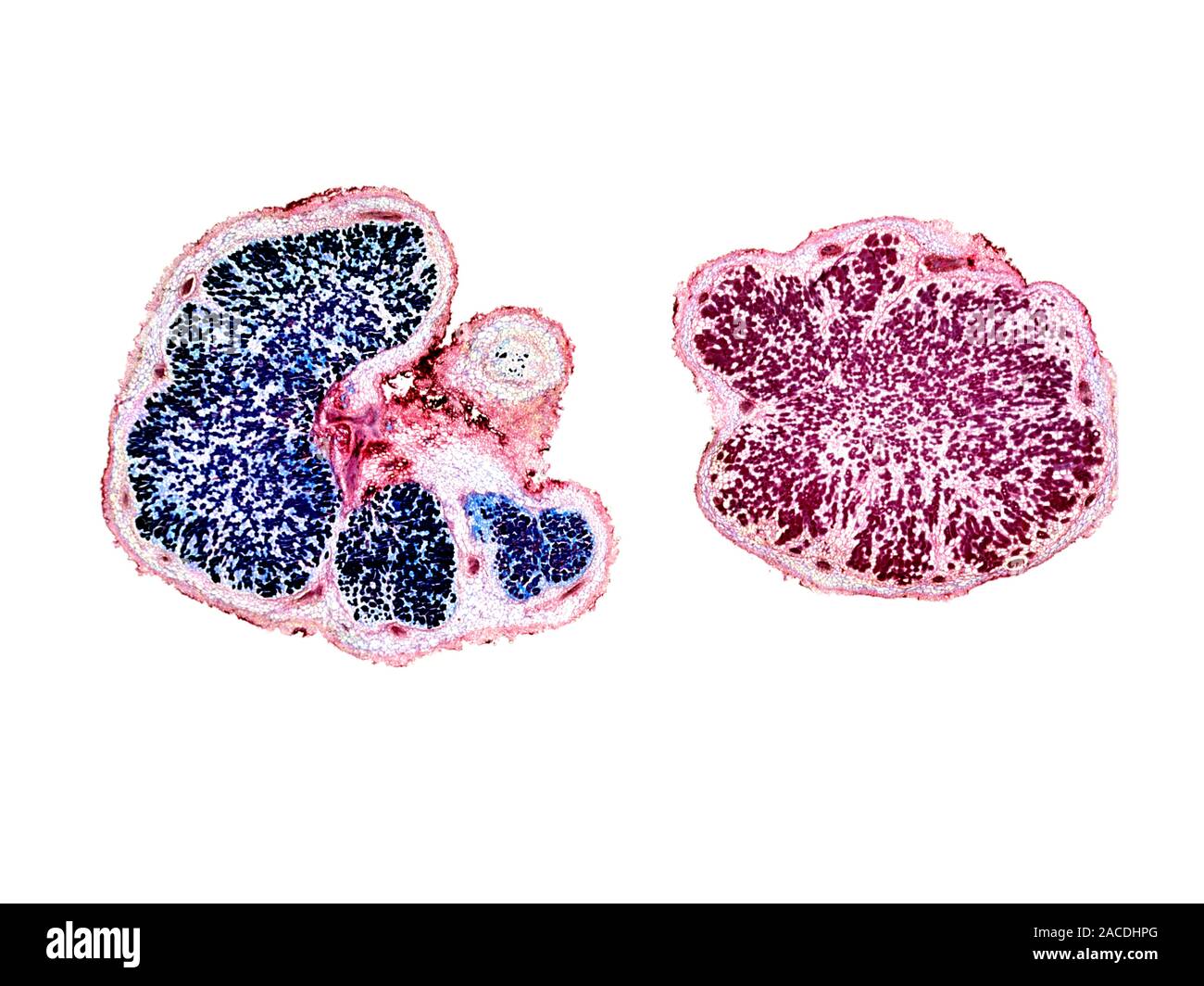 Legume root nodules. Light micrograph of sections through two root ...