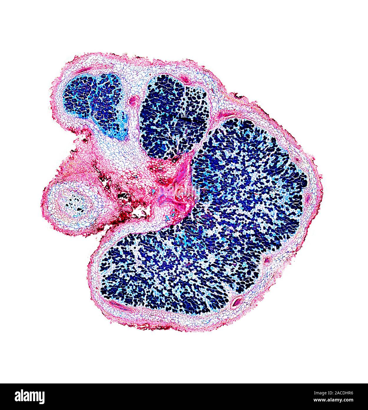 Broad bean root nodules. Light micrograph of the sections of the root ...