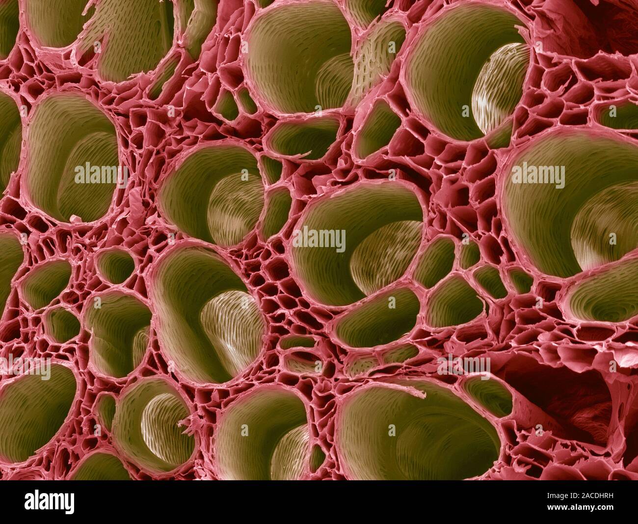Xylem tissue. Coloured scanning electron micrograph (SEM) of a section ...
