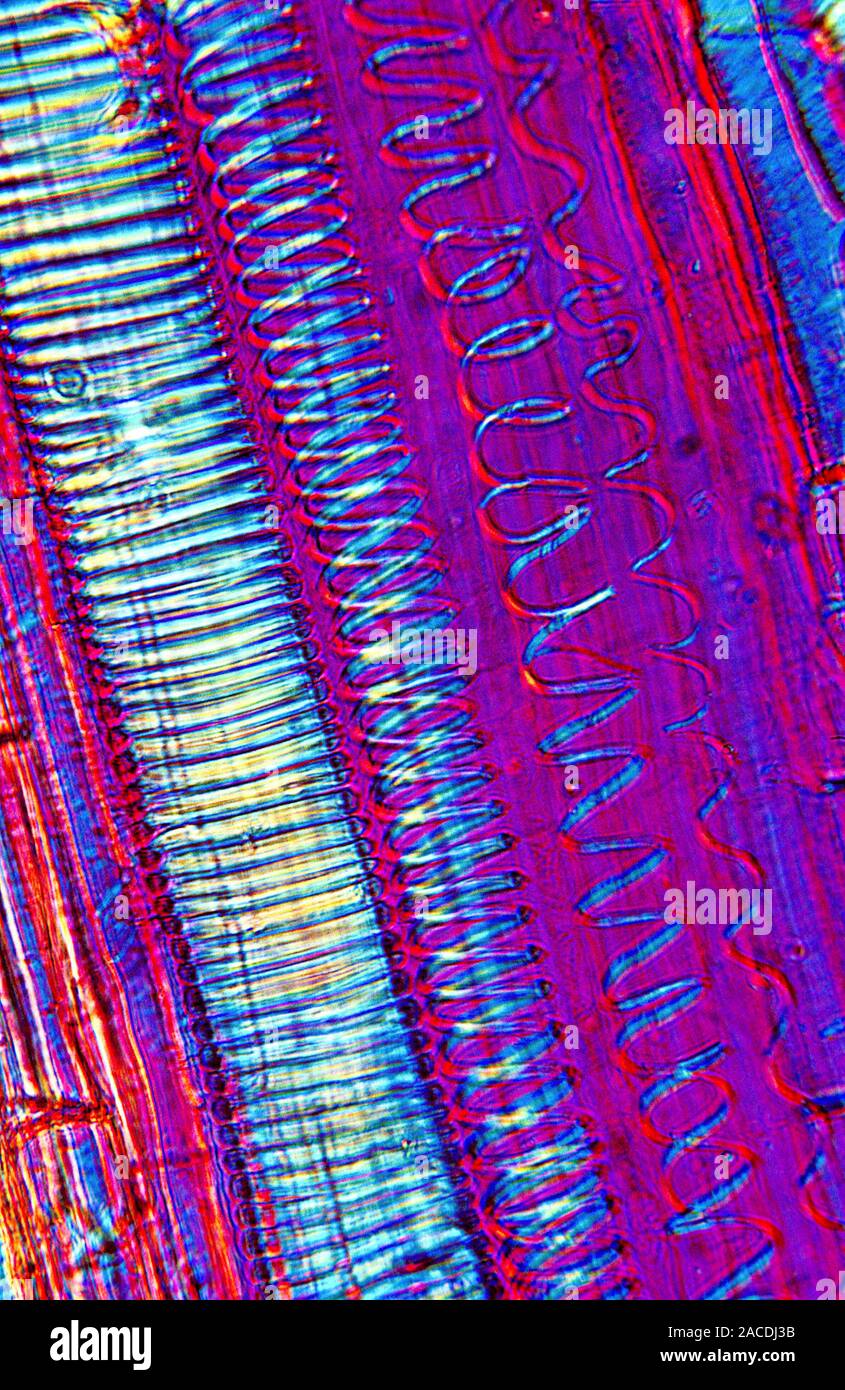 Primary wood of a tree. Light micrograph of a vertical section of the ...