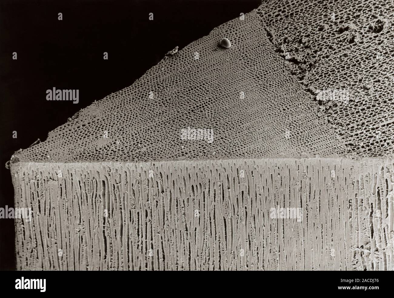 Scanning electron micrograph of the wood (secondary xylem) of the Scots ...