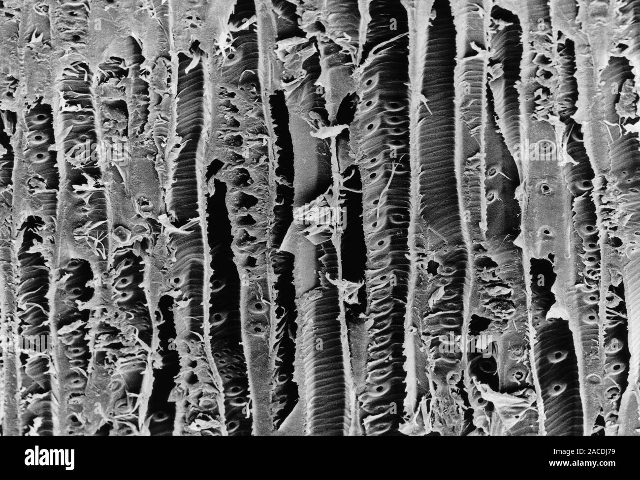 Scanning electron micrograph of a vertical section through the wood ...