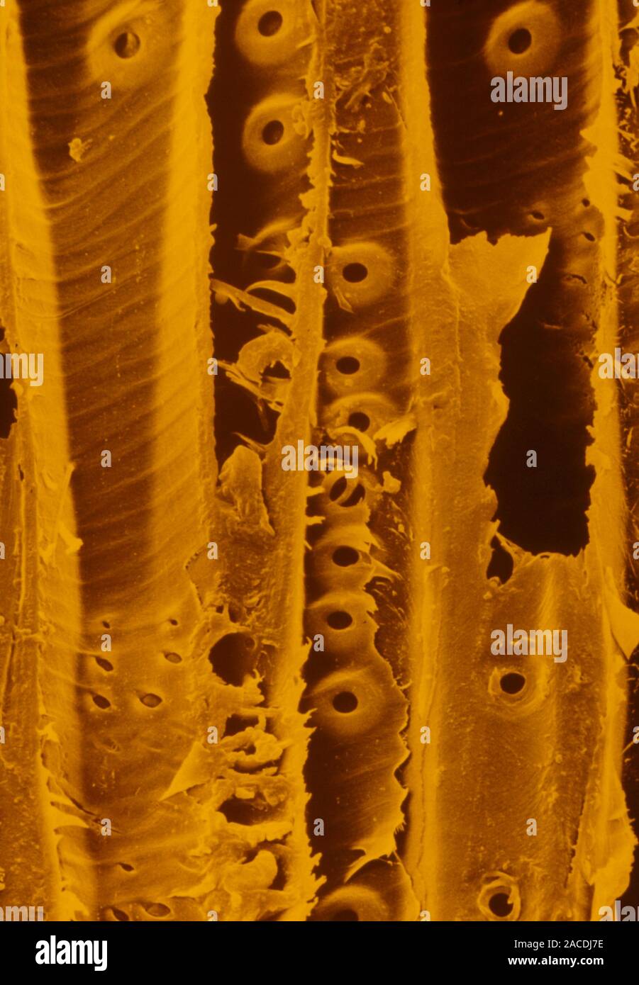 False-colour scanning electron micrograph of a vertical section through ...