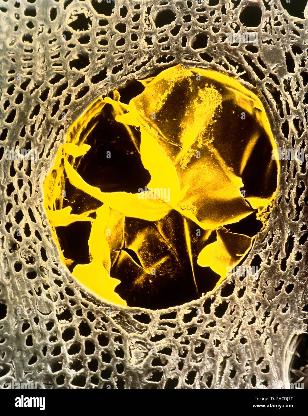 False-colour scanning electron micrograph of a horizontal section ...