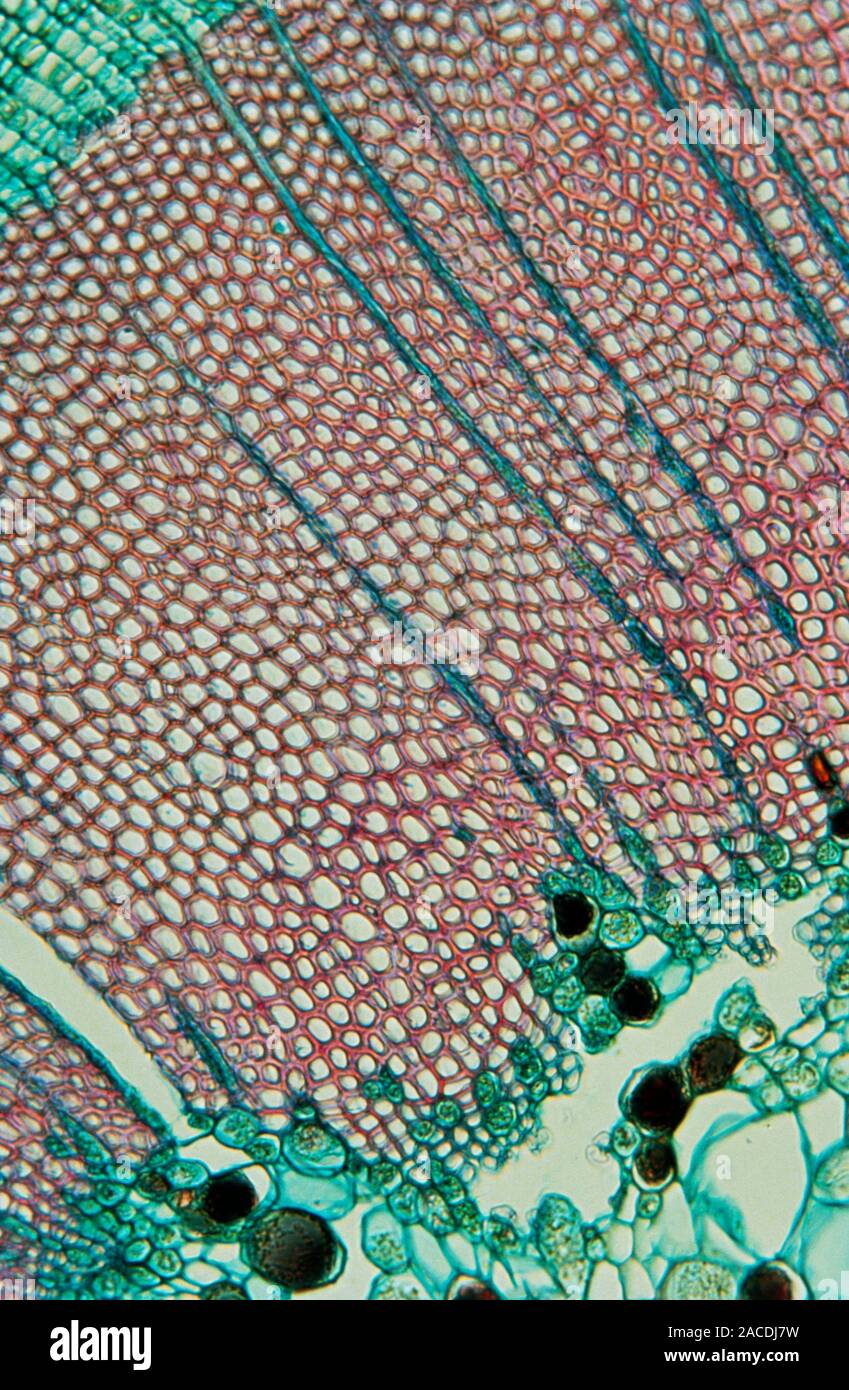 Light micrograph of a transverse section through a yew tree (Taxus sp ...