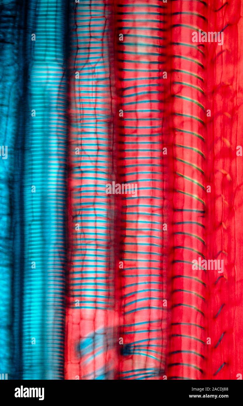 Xylem. Light micrograph of spirally-thickened xylem elements in a ...