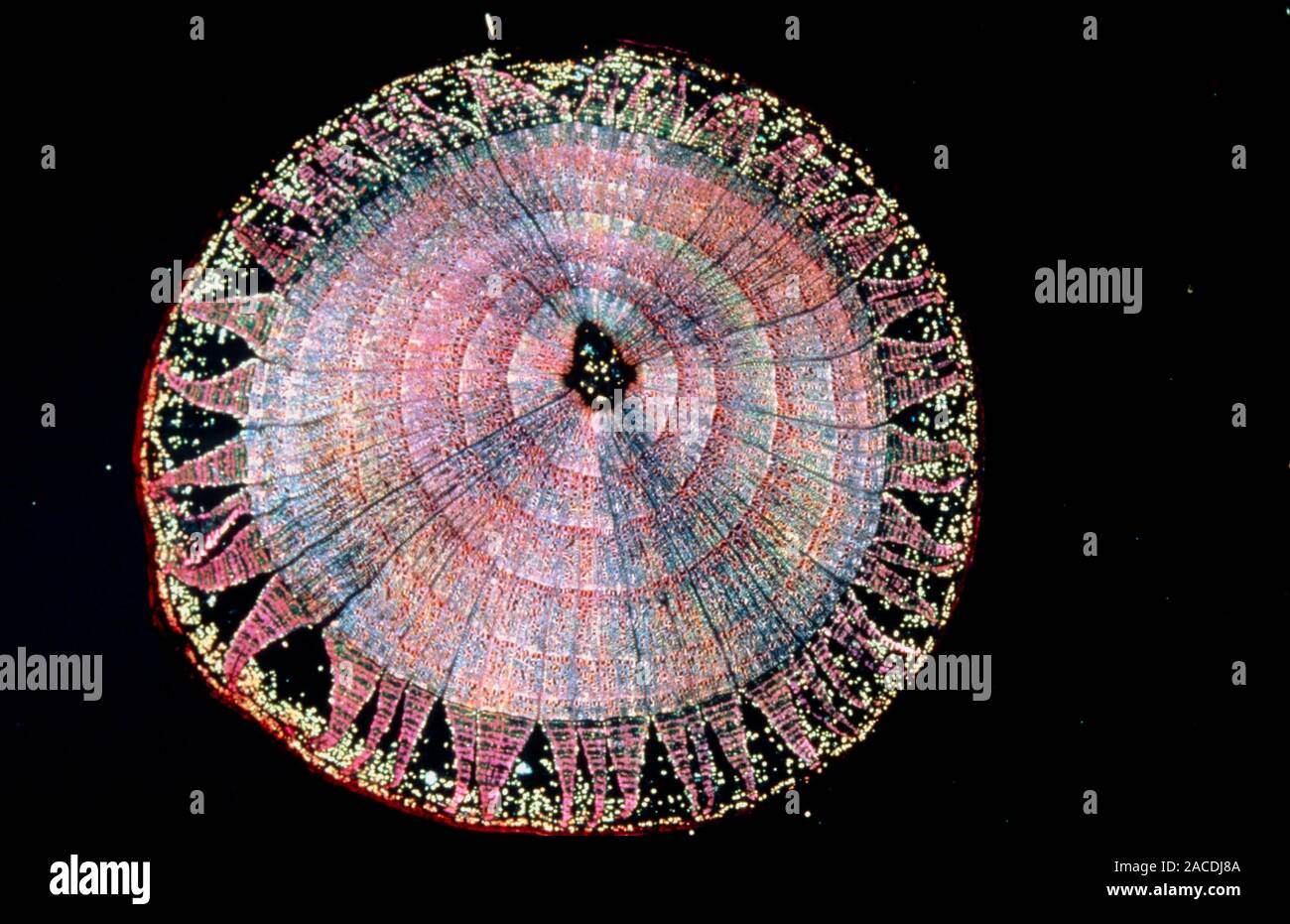 Light micrograph of a transverse section through a six year old lime ...