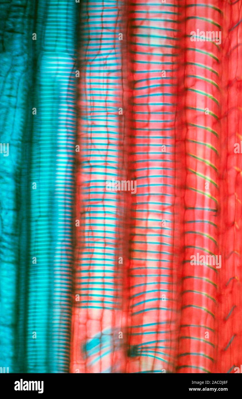 Light micrograph of spirally-thickened xylem elements in a longitudinal ...