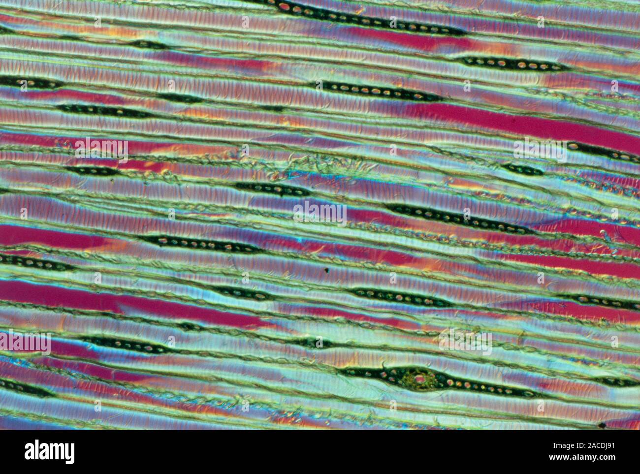 Xylem. Light micrograph of xylem vessels in a pine branch, viewed in ...