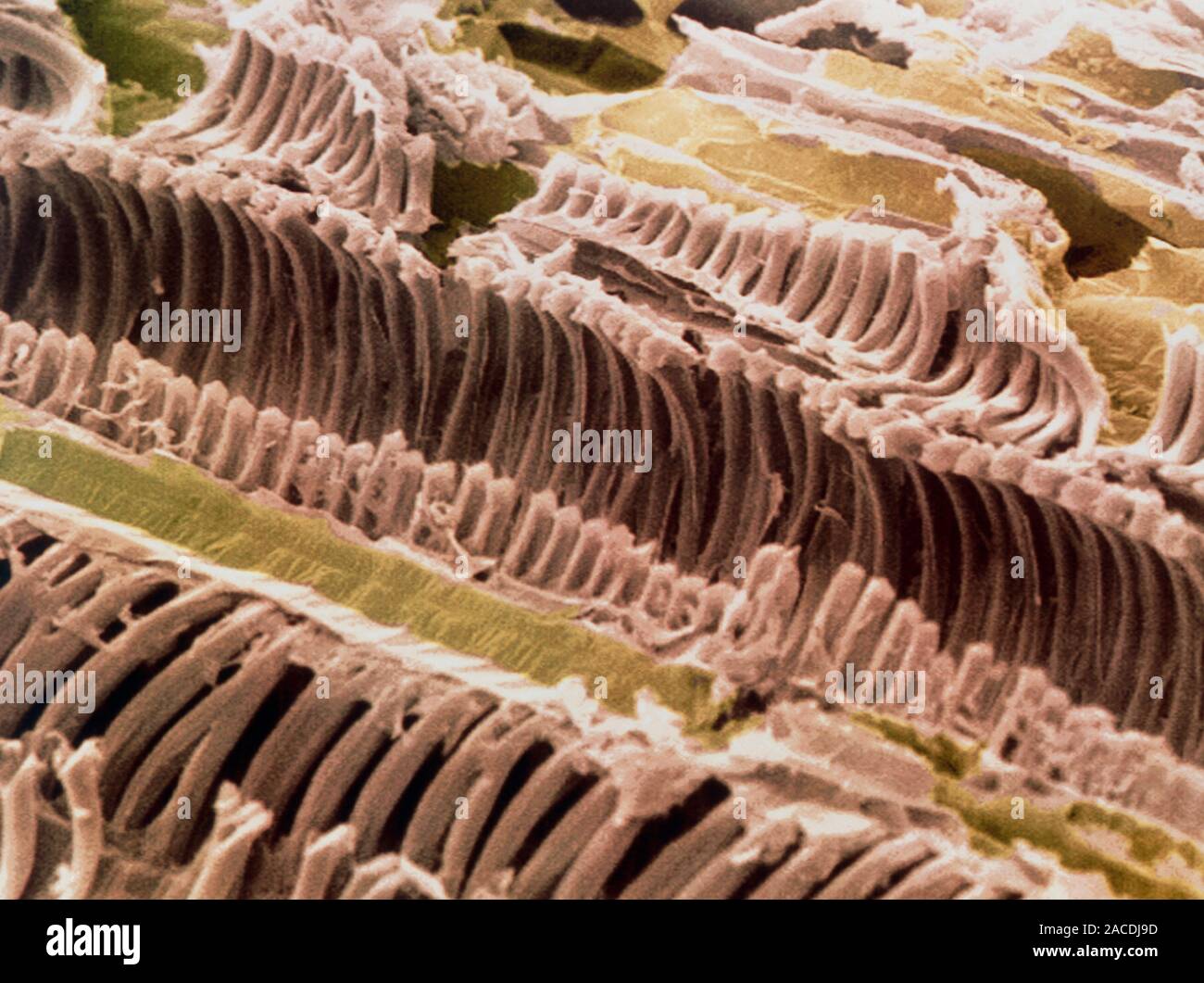 Rhubarb stem. Coloured scanning electron micrograph (SEM) of a ...