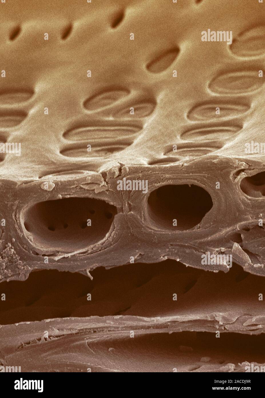 Oak xylem. Coloured scanning electron micrograph (SEM) of a section ...