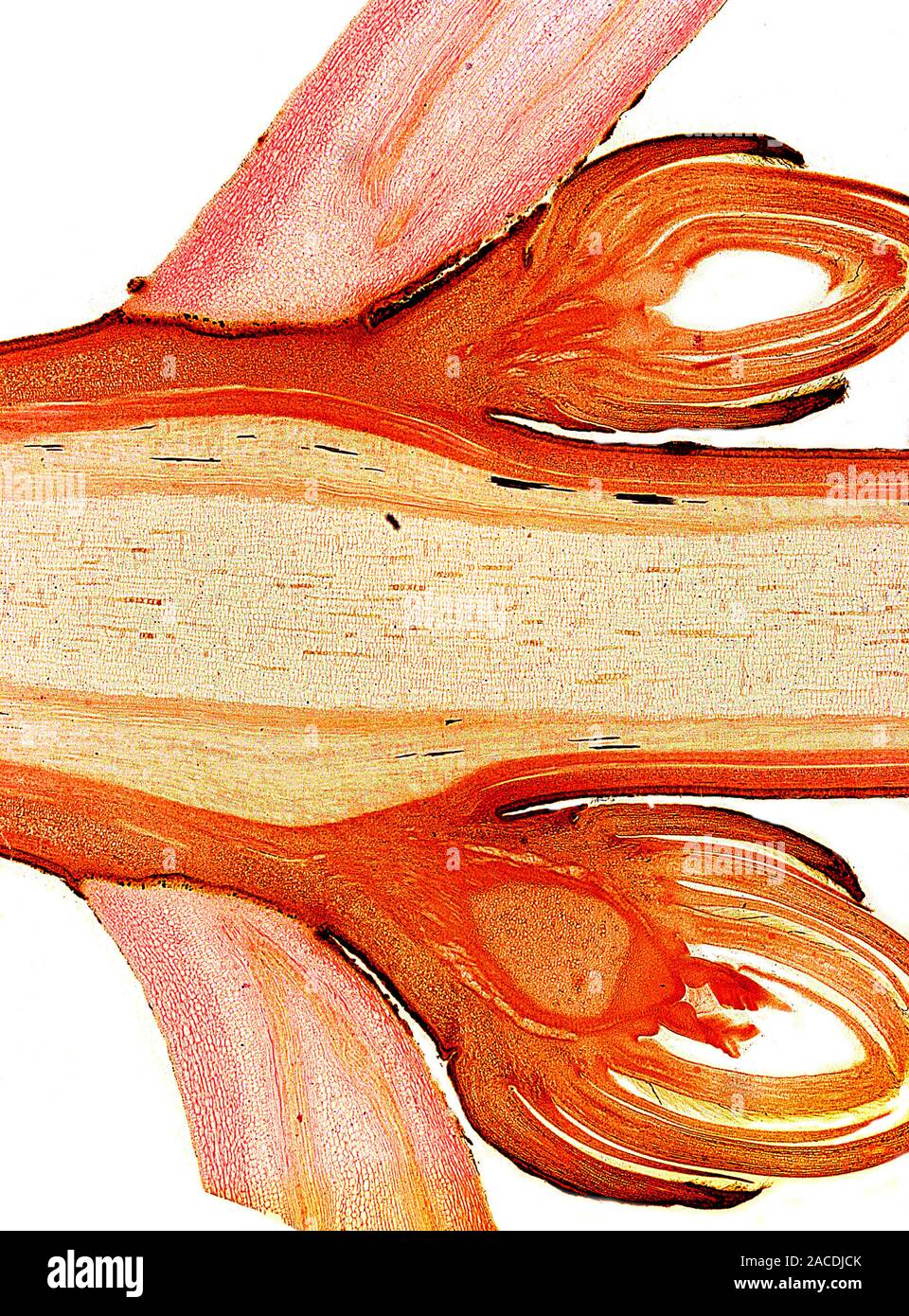 Sycamore stem. Light micrograph of a vertical section through a ...