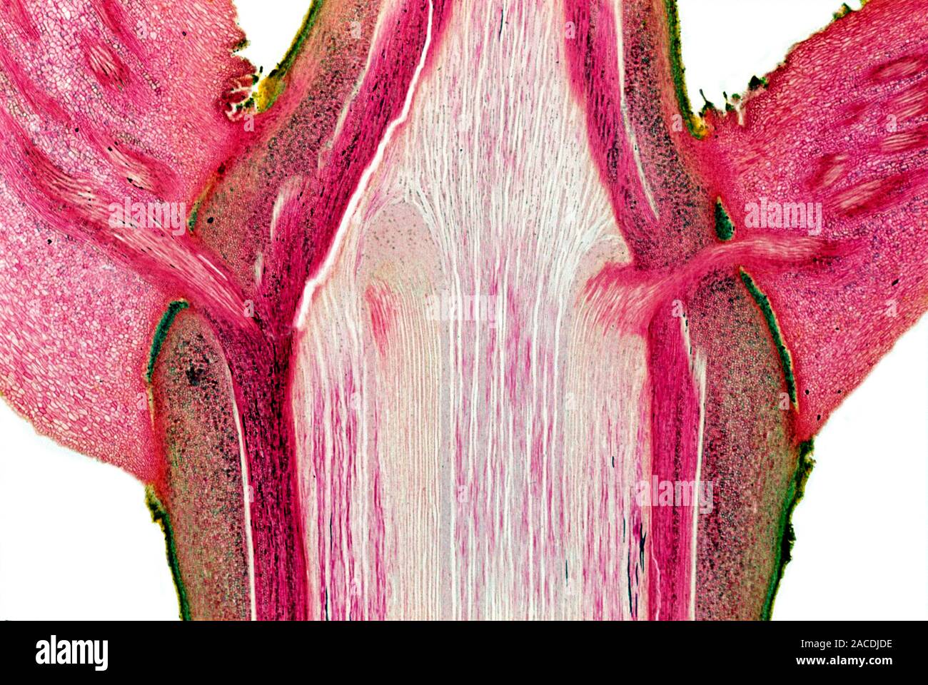 Leaf stem node. Light micrograph of a vertical section through a leaf ...