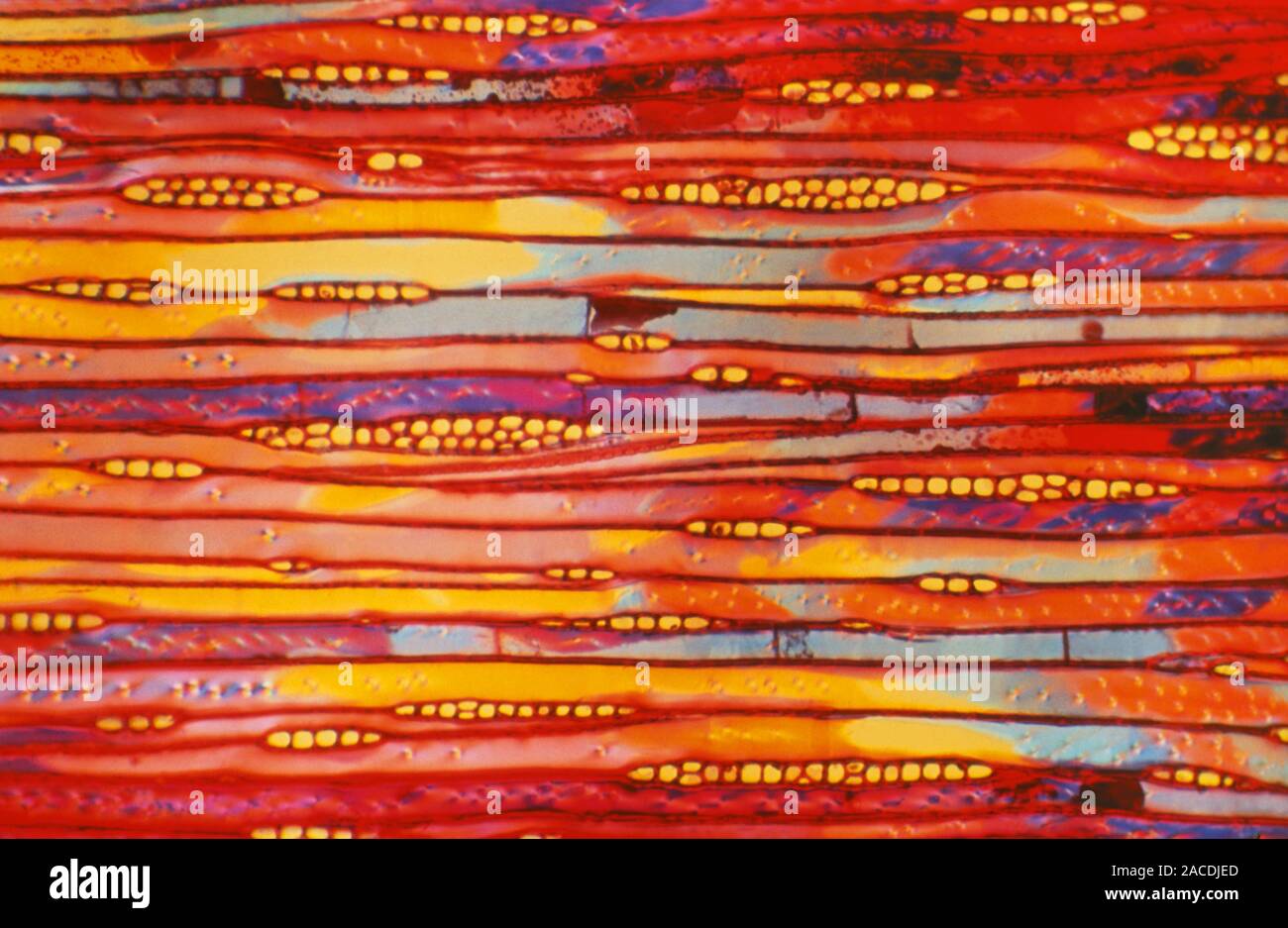 Xylem vessels, light micrograph. These are from the wood of a coast ...
