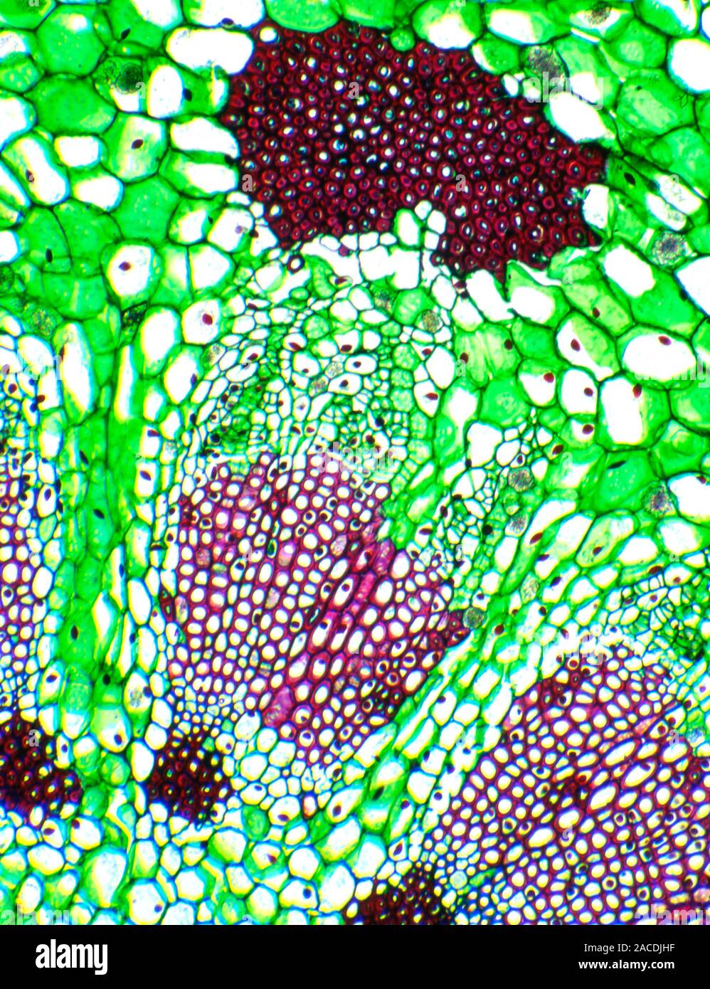 Mistletoe vascular bundle. Light micrograph (LM) of a section of ...