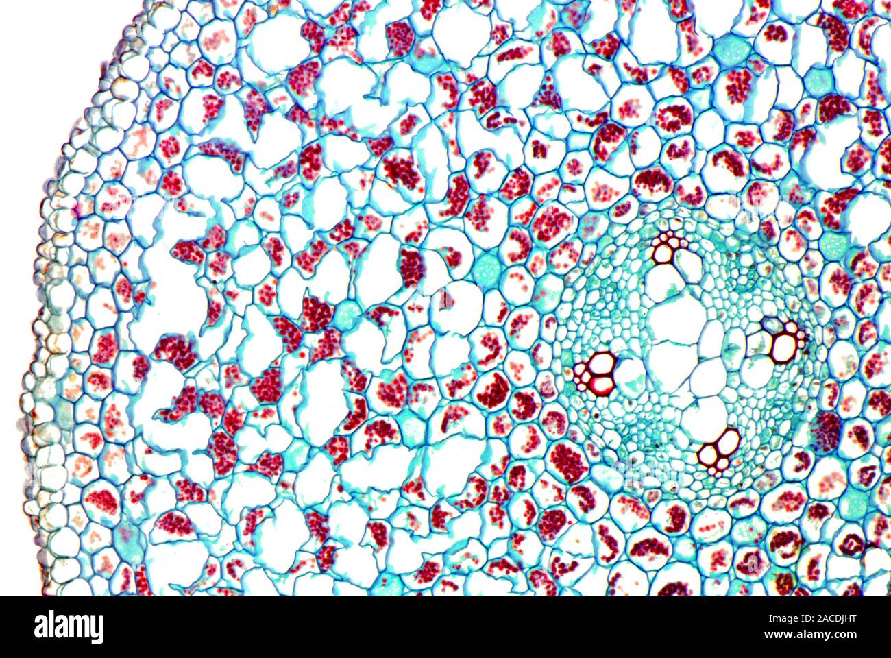 Buttercup stem. Coloured light micrograph of a section through a ...