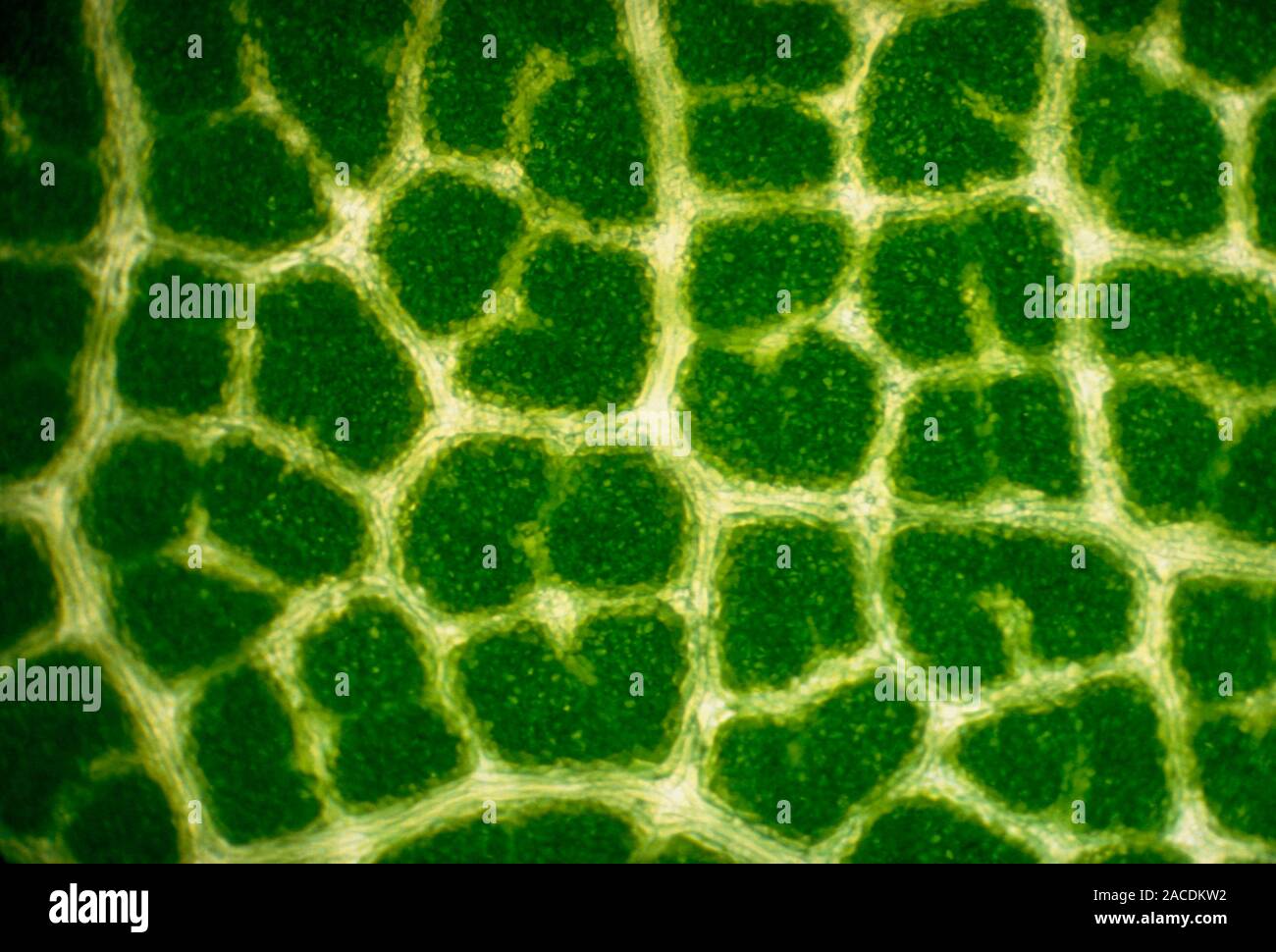 Light micrograph of the surface of a leaf of a sugar maple tree, Acer ...