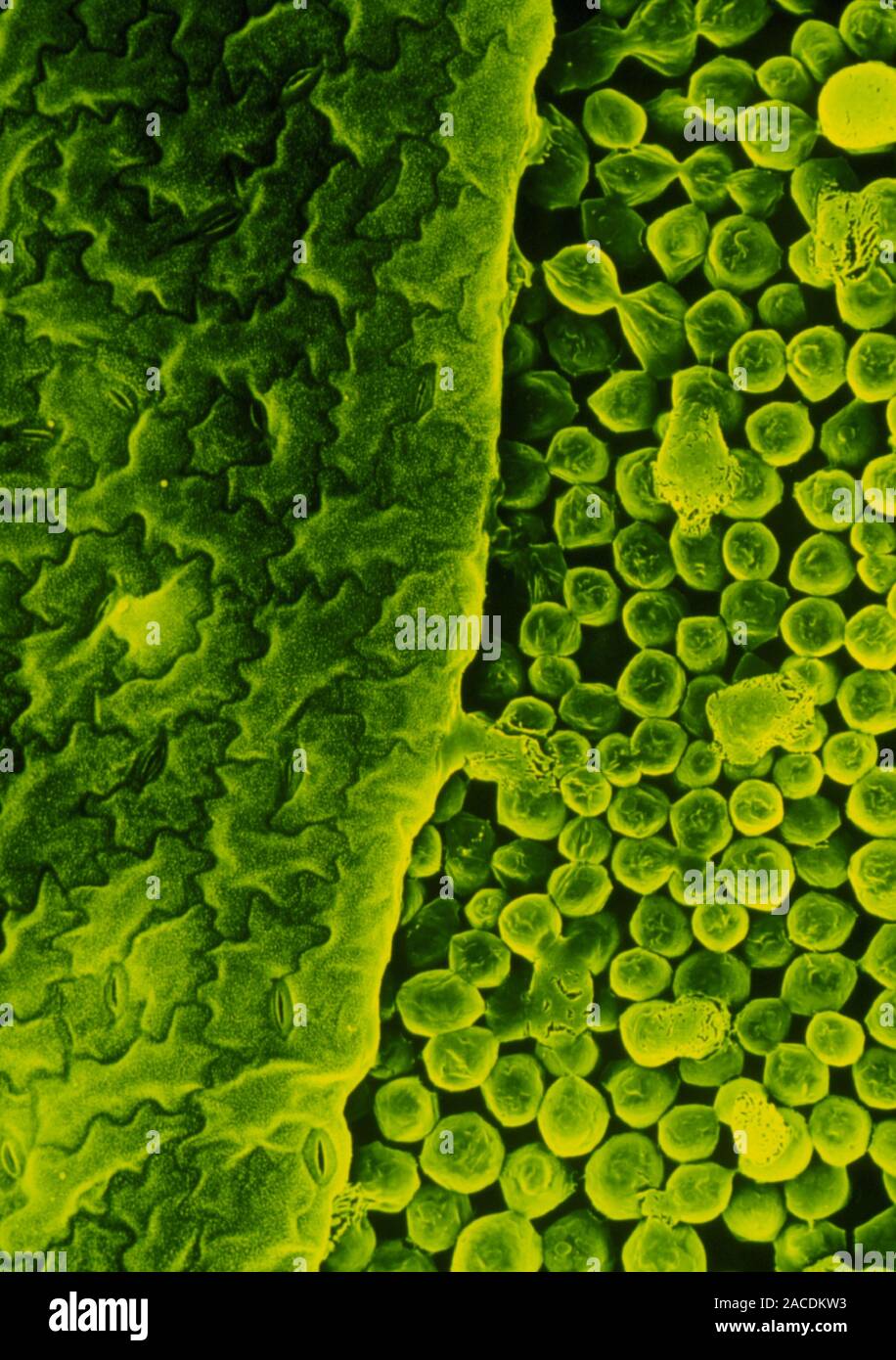 Scanning electron micrograph (coloured green) of the upper surface of a ...