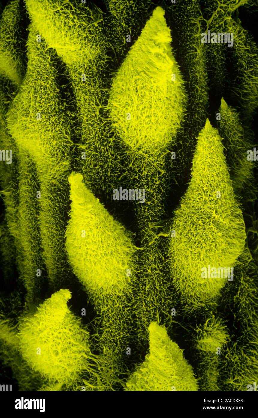 False colour scanning electron micrograph of the leaf surface of marram ...