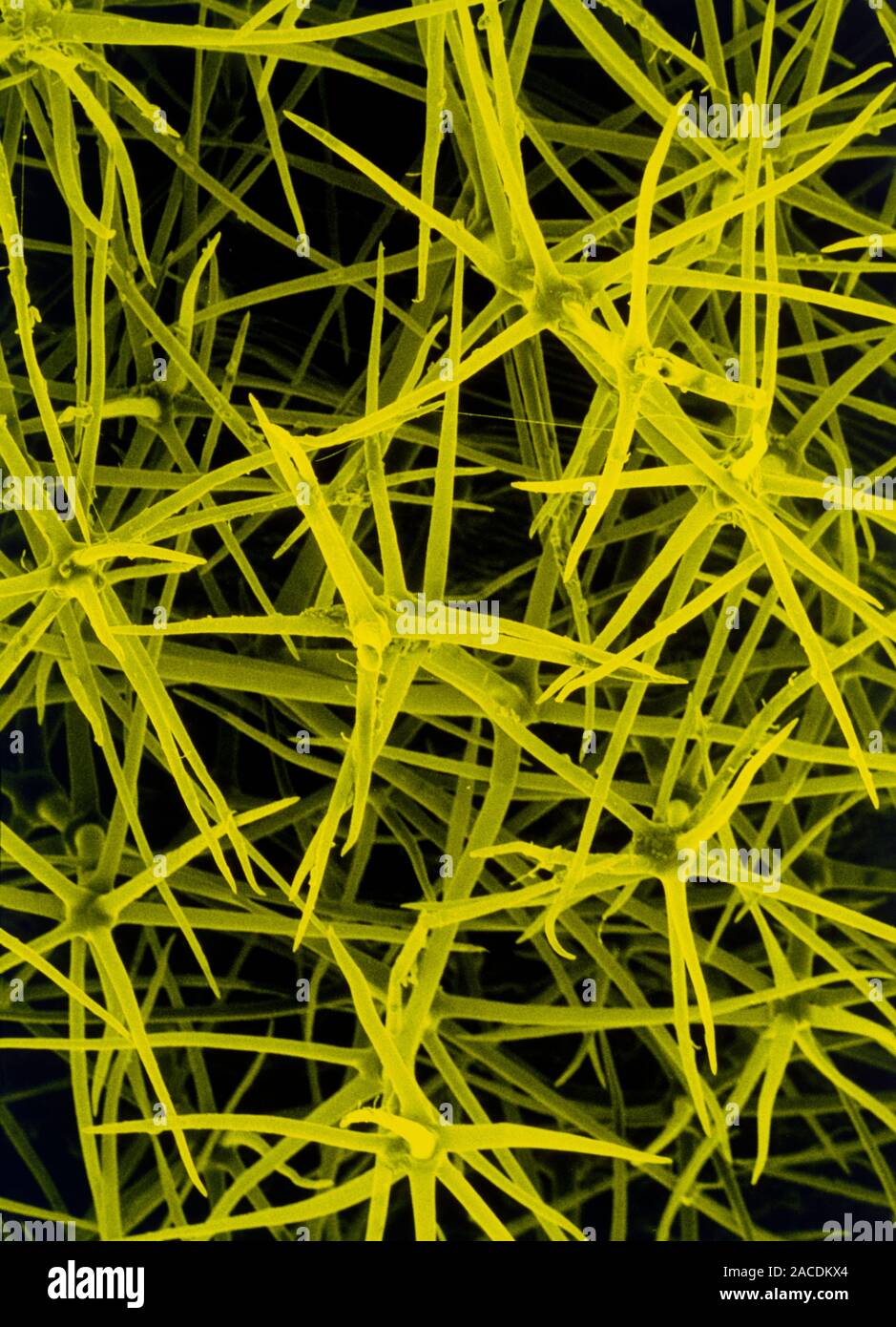 False colour scanning electron micrograph of stellate leaf hairs on the ...