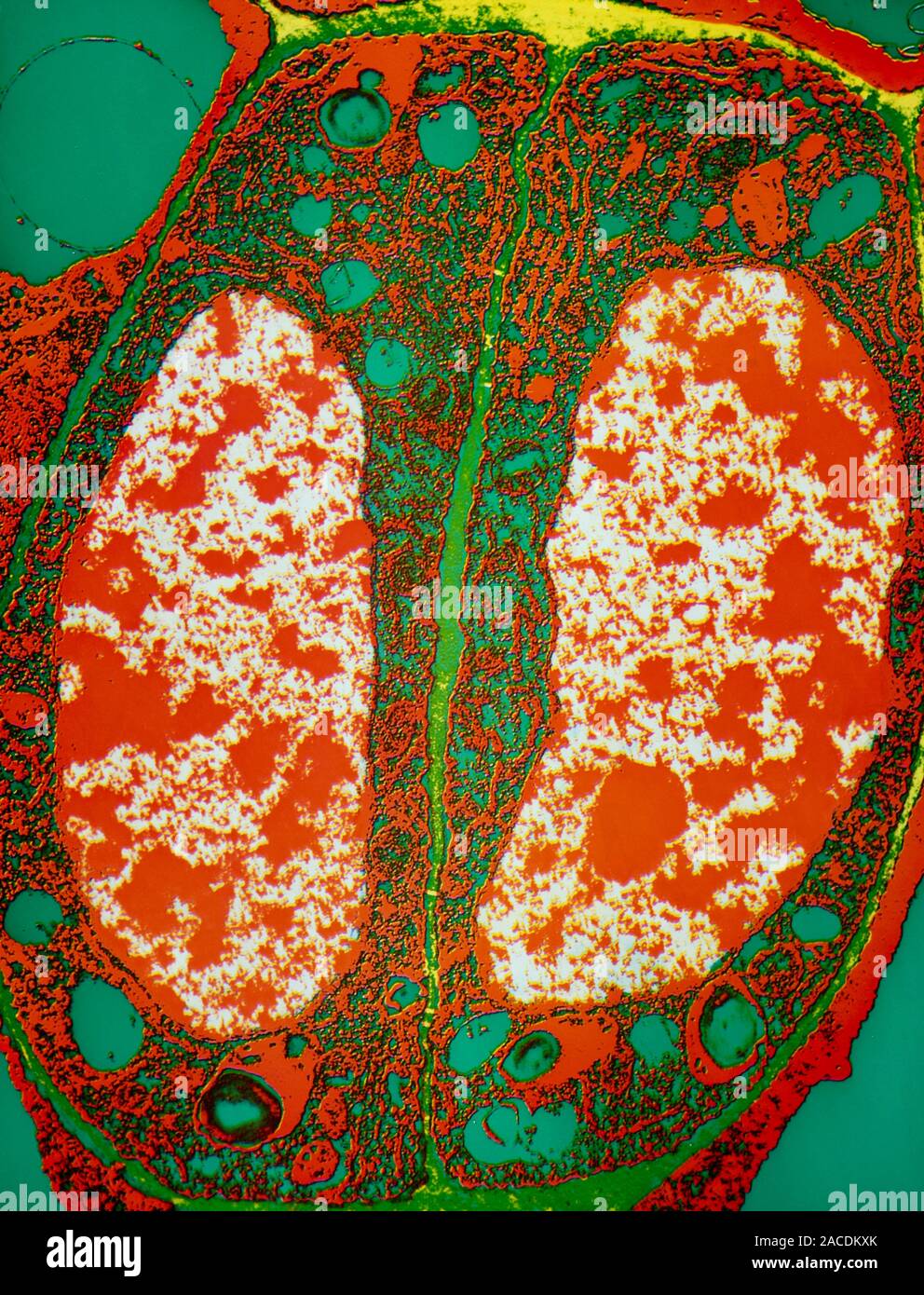 False-colour transmission electron micrograph of a stomatal complex in ...