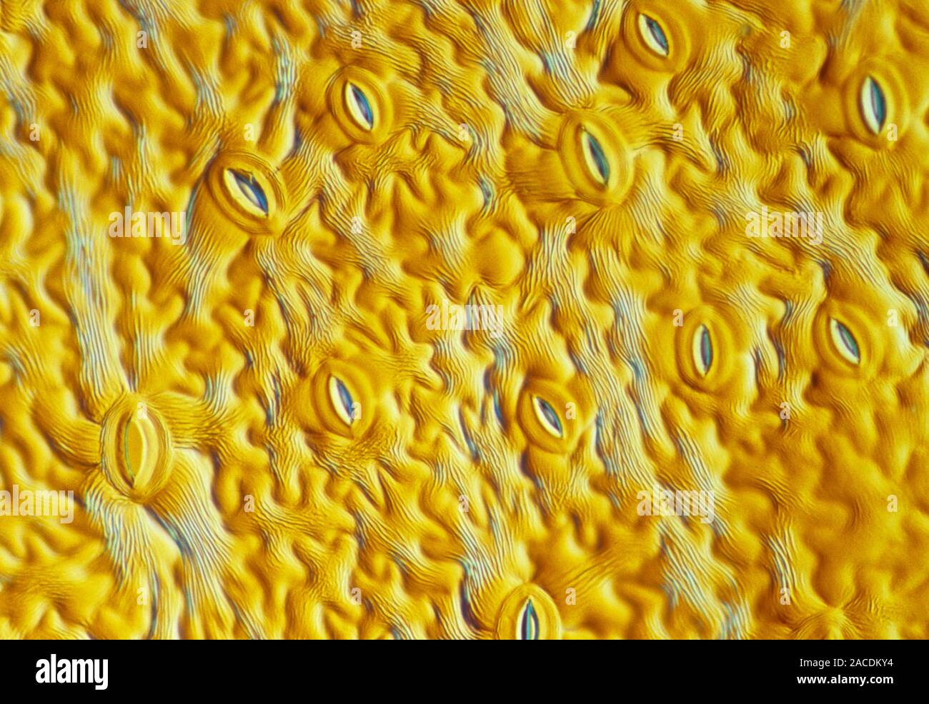 Light micrograph of the surface of a leaf of the elder tree, Sambucus ...