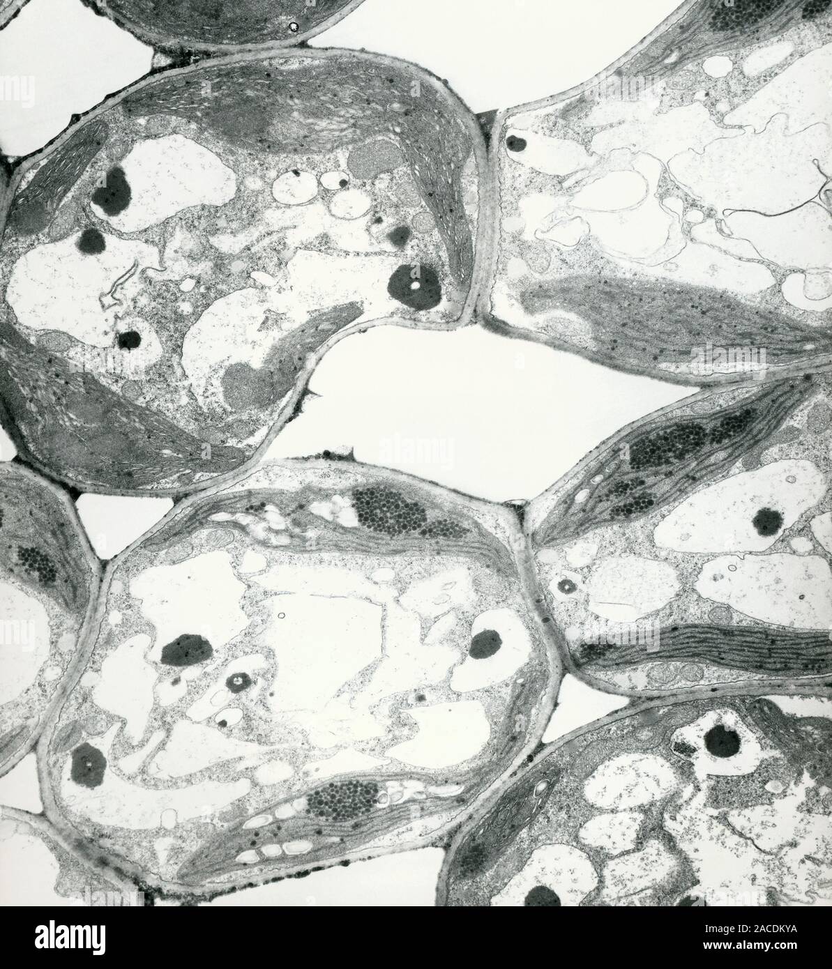 Leaf cell rehydration (1 week). Transmission electron micrograph (TEM ...
