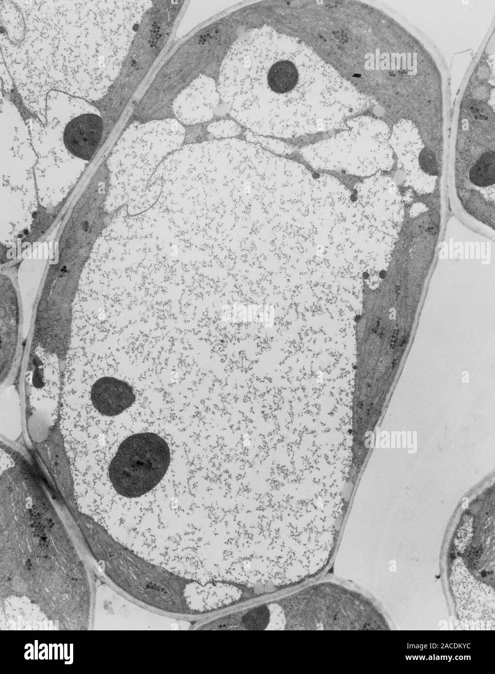 Leaf cell rehydration (12 hours). Transmission electron micrograph (TEM ...