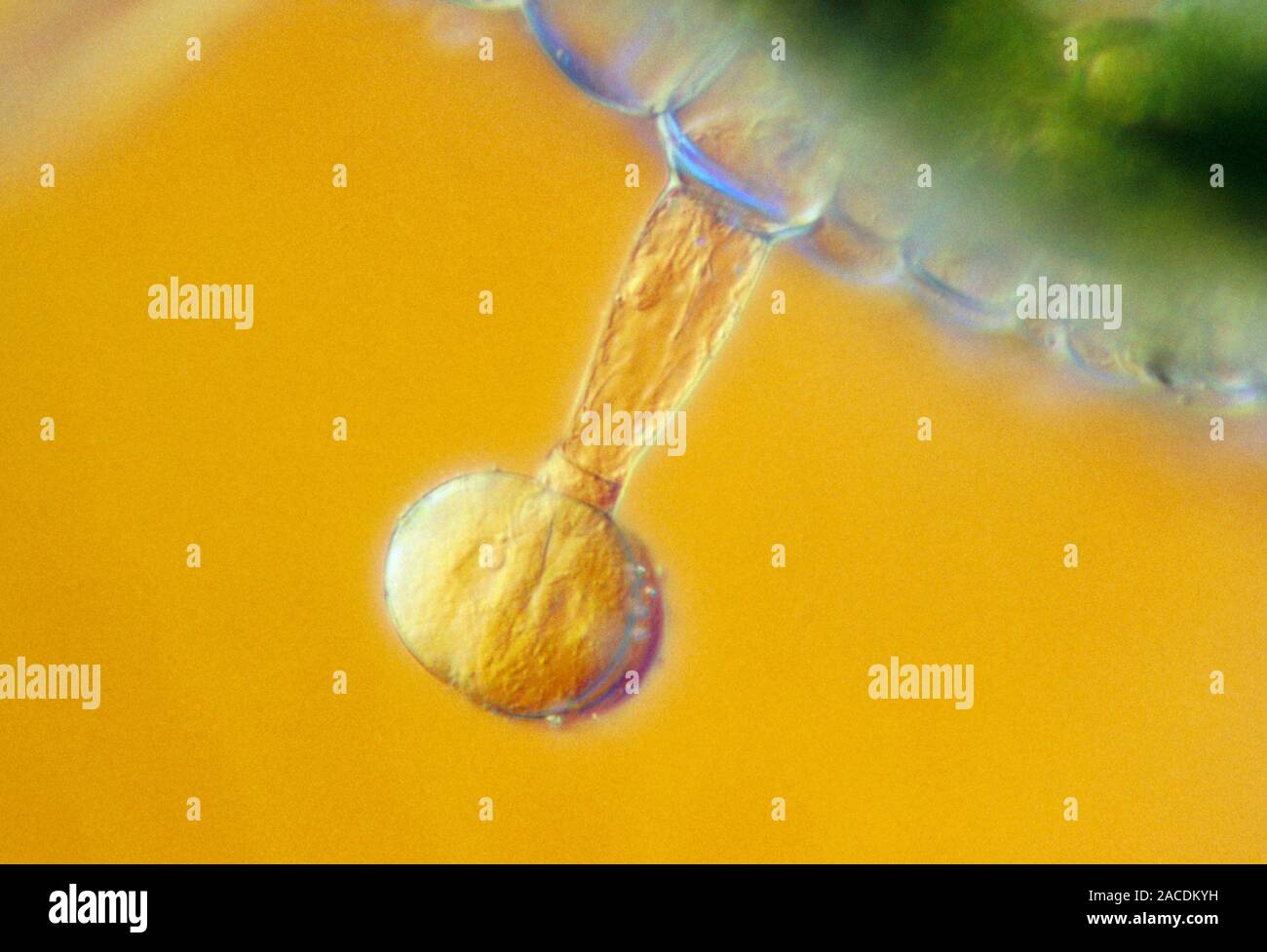Light micrograph in interference contrast illumination of a trichome on ...