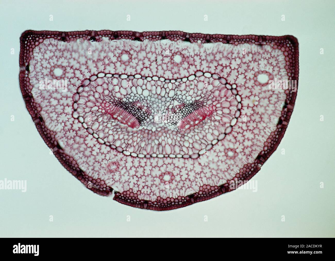 Light micrograph of a transverse section through the needle (leaf) of a ...