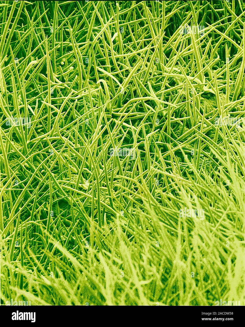 Marsh mallow leaf. Coloured scanning electron micrograph (SEM) of a ...