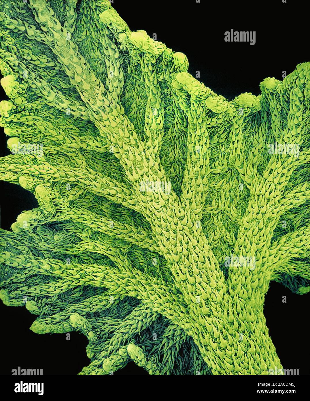 Young Leaf Coloured Scanning Electron Micrograph Sem Of The Underside Of An Unidentified